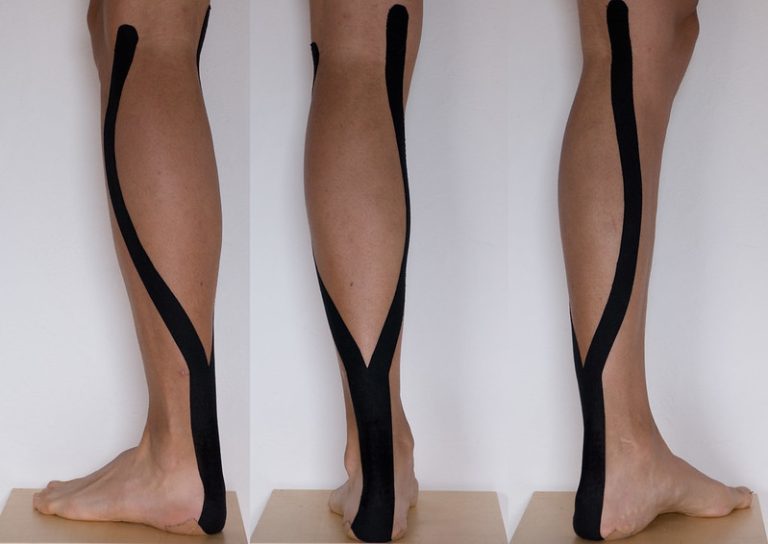 What Is the Kinesio Taping Method? [Know How it Works]